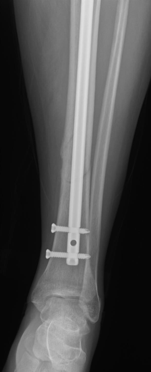 Question 4018 - Qbank - Orthobullets