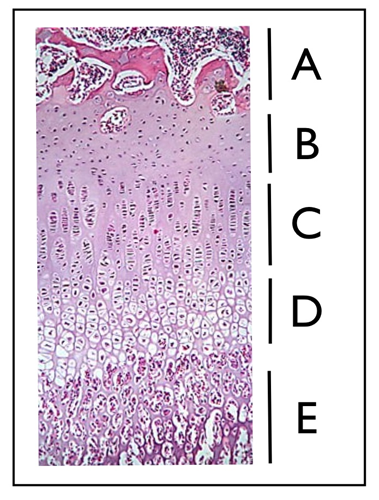 Scurvy - Basic Science - Orthobullets
