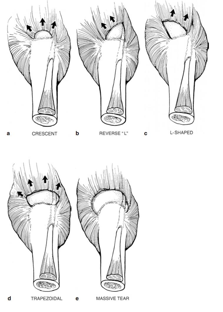 Question 4501 - Qbank - Orthobullets