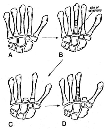 Question 4518 - Qbank - Orthobullets