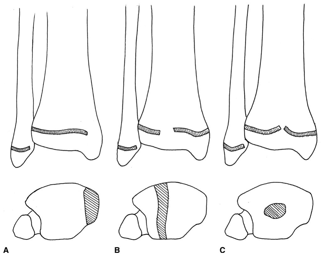 Question 4648 - Qbank - Orthobullets