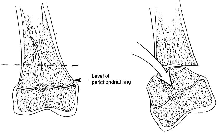 Question 4648 - Qbank - Orthobullets