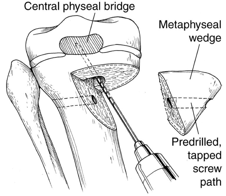 Question 4648 - Qbank - Orthobullets