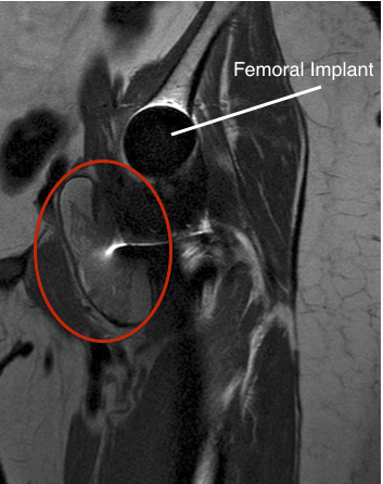 Question 4655 - Qbank - Orthobullets