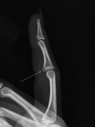 Question 4663 - Qbank - Orthobullets