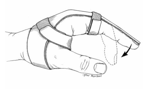 Question 4663 - Qbank - Orthobullets