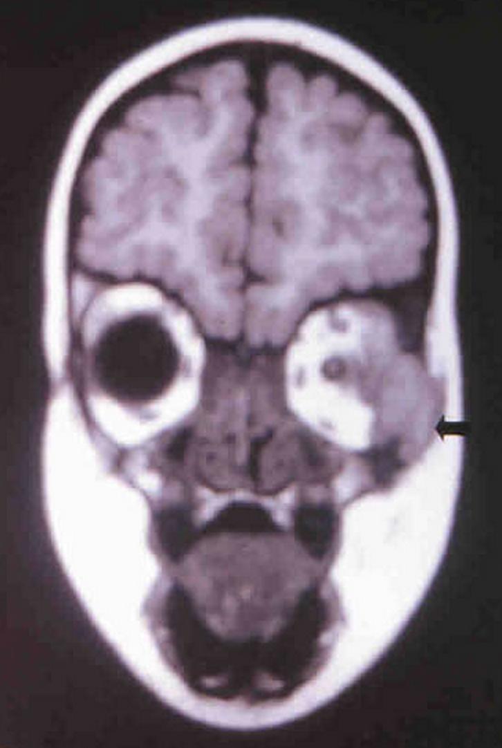Question 4682 - Qbank - Orthobullets