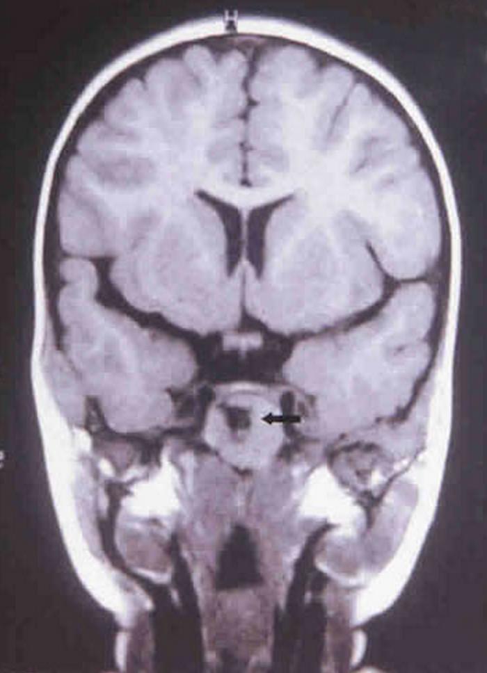 Question 4682 - Qbank - Orthobullets
