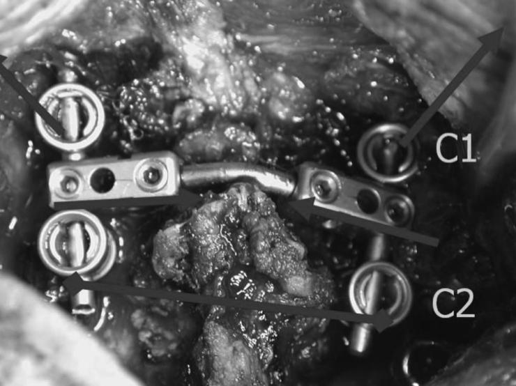 Question 4690 - Qbank - Orthobullets