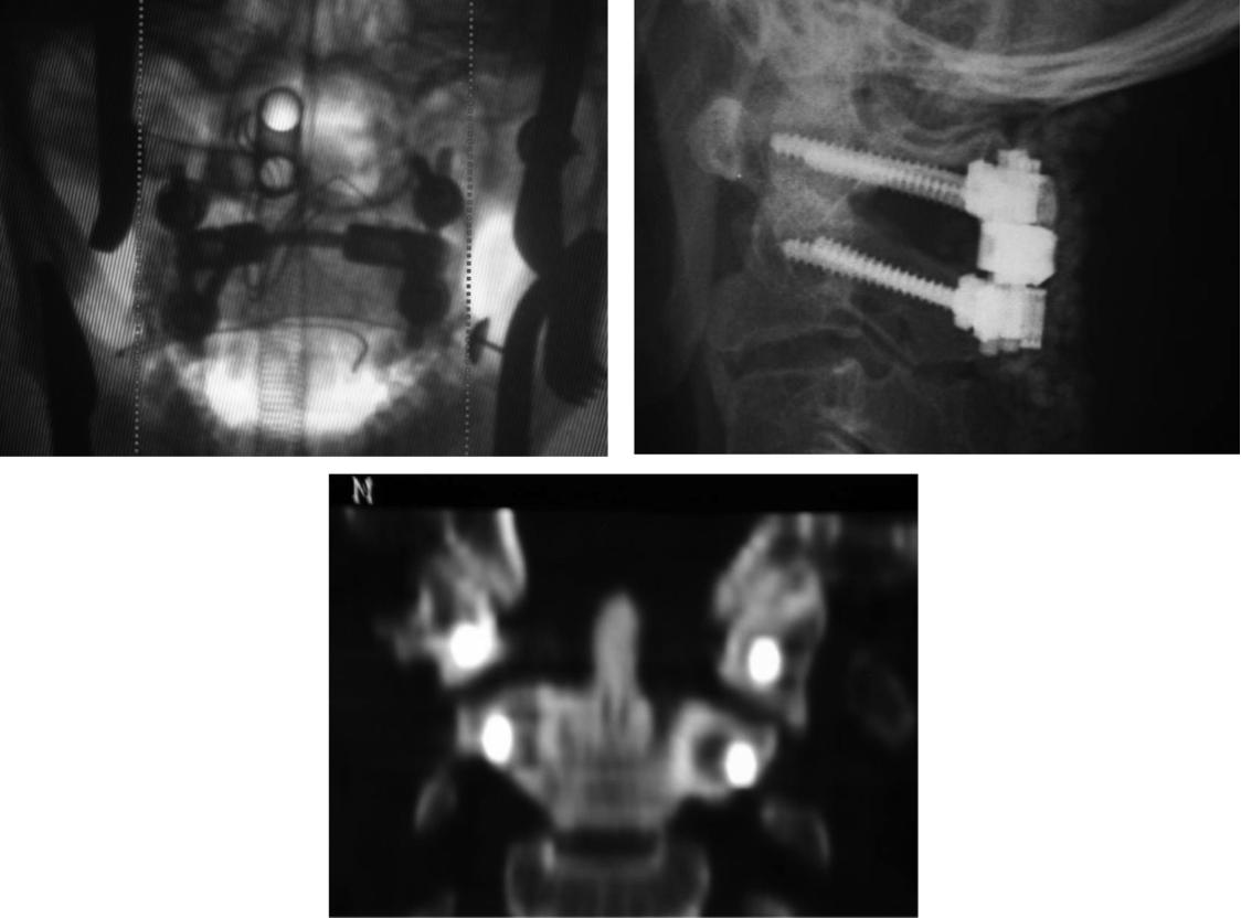 Question 4690 - Qbank - Orthobullets