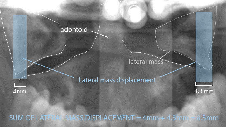 Question 4690 - Qbank - Orthobullets