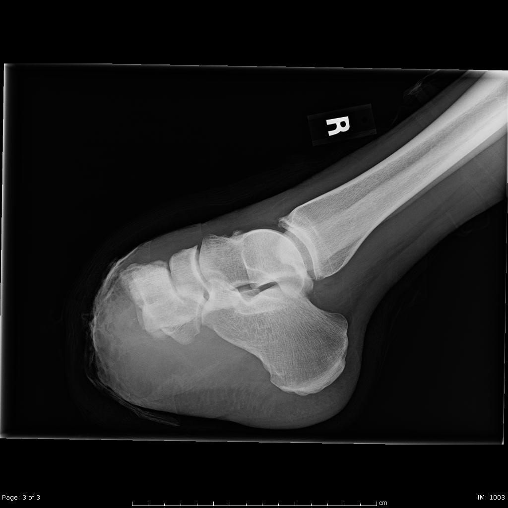 Question 4716 - Qbank - Orthobullets