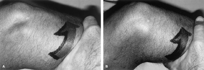Question 4723 - Qbank - Orthobullets