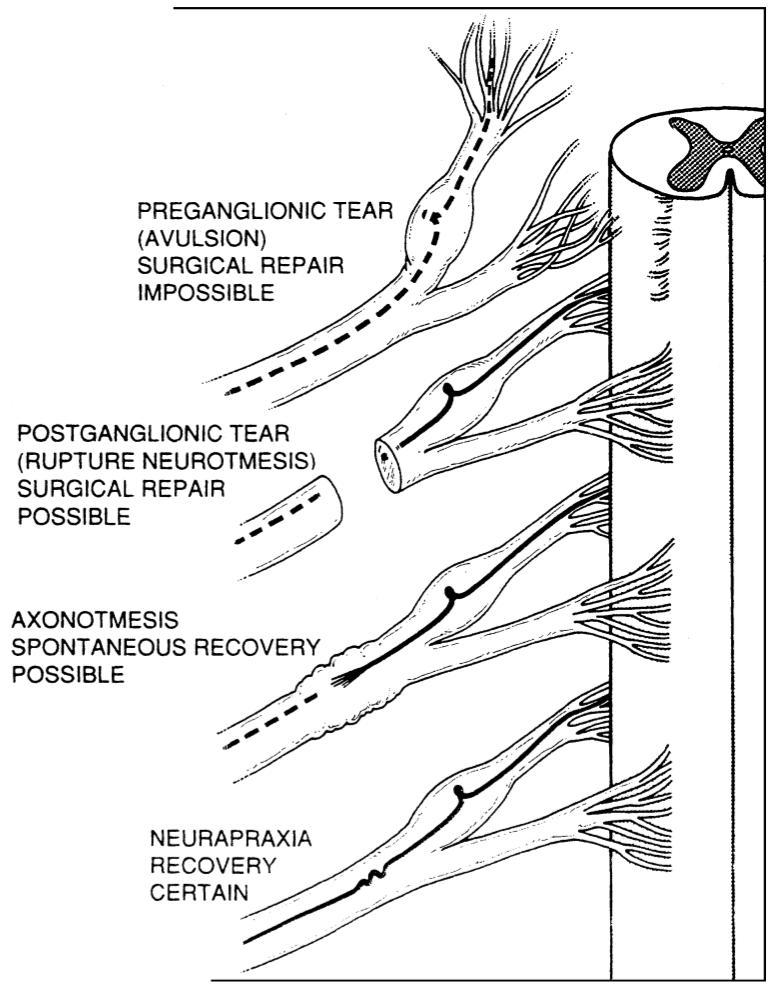 Question 4732 - Qbank - Orthobullets