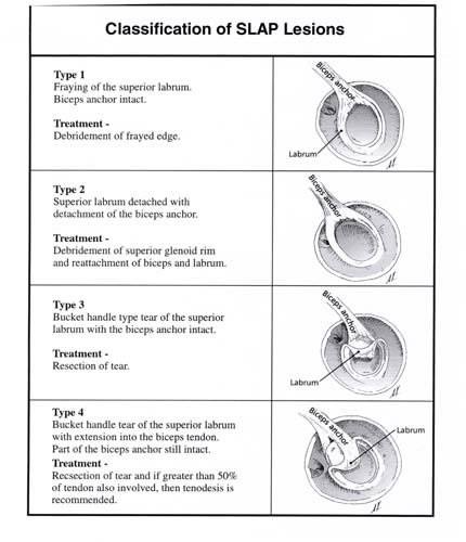 Question 4736 - Qbank - Orthobullets