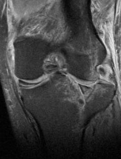 Question 4737 - Qbank - Orthobullets