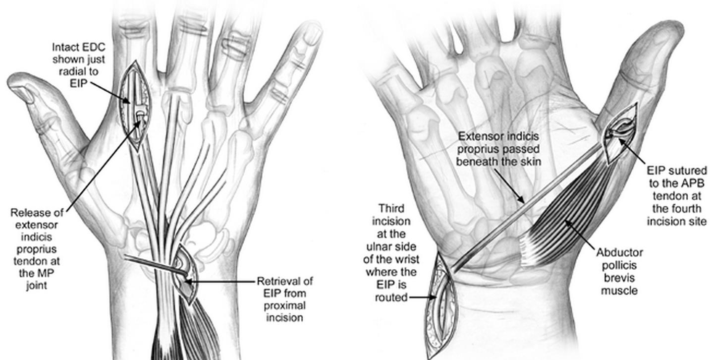 Question 4738 - Qbank - Orthobullets