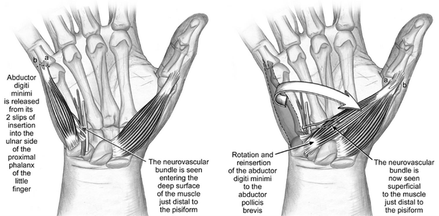 Question 4738 - Qbank - Orthobullets