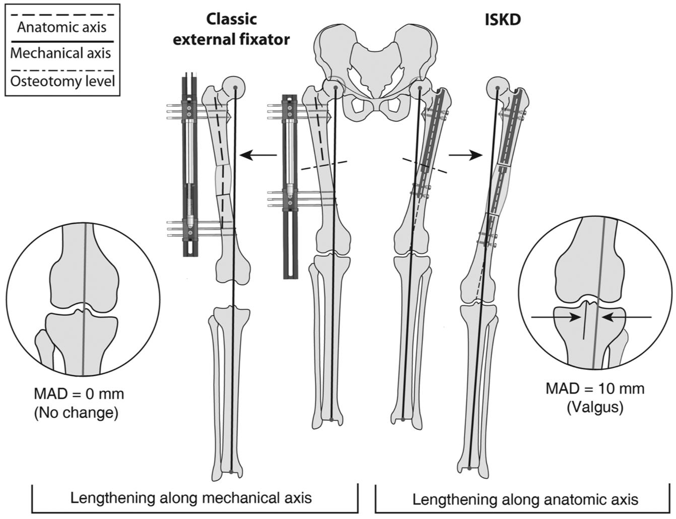 Question 4742 - Qbank - Orthobullets