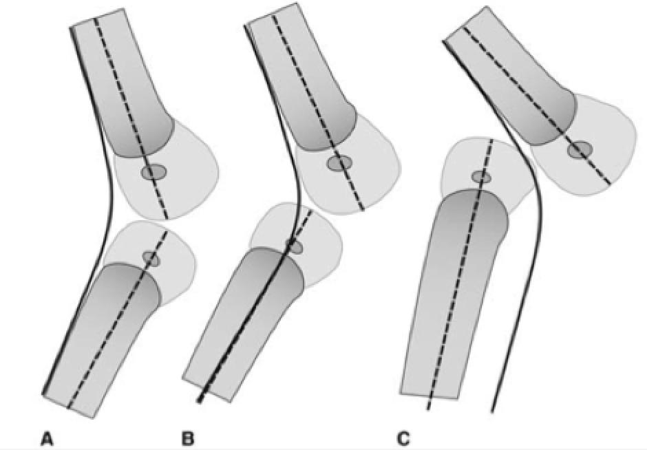 Question 4749 - Qbank - Orthobullets