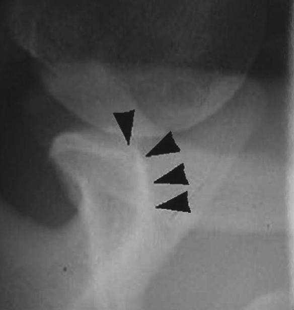 Question 4753 - Qbank - Orthobullets