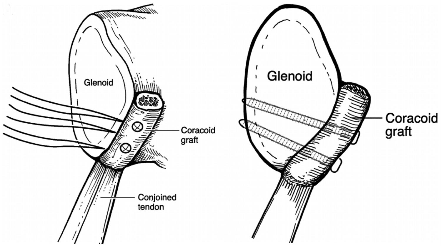 Question 4753 - Qbank - Orthobullets