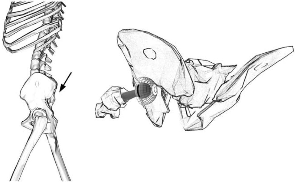 Question 4756 - Qbank - Orthobullets