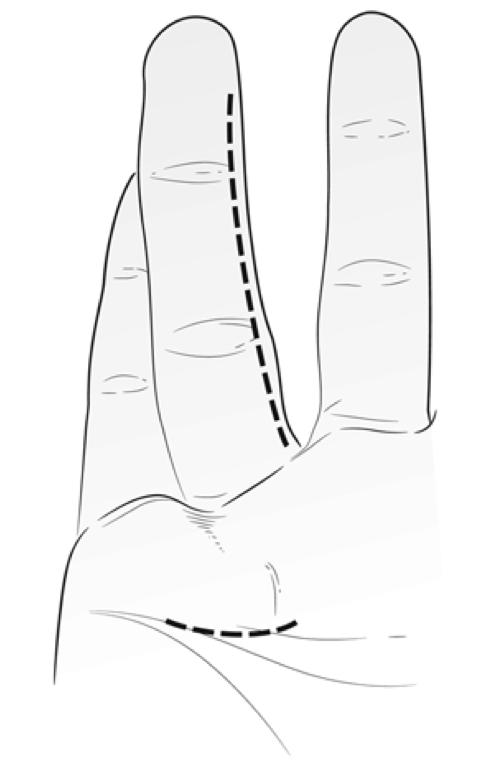 Question 4768 - Qbank - Orthobullets