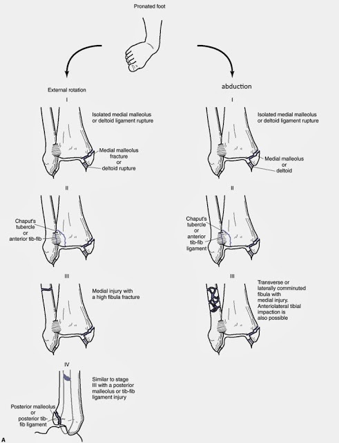 Question 4772 - Qbank - Orthobullets