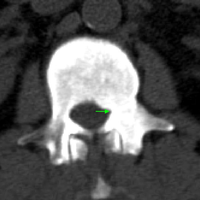 Question 4776 - Qbank - Orthobullets