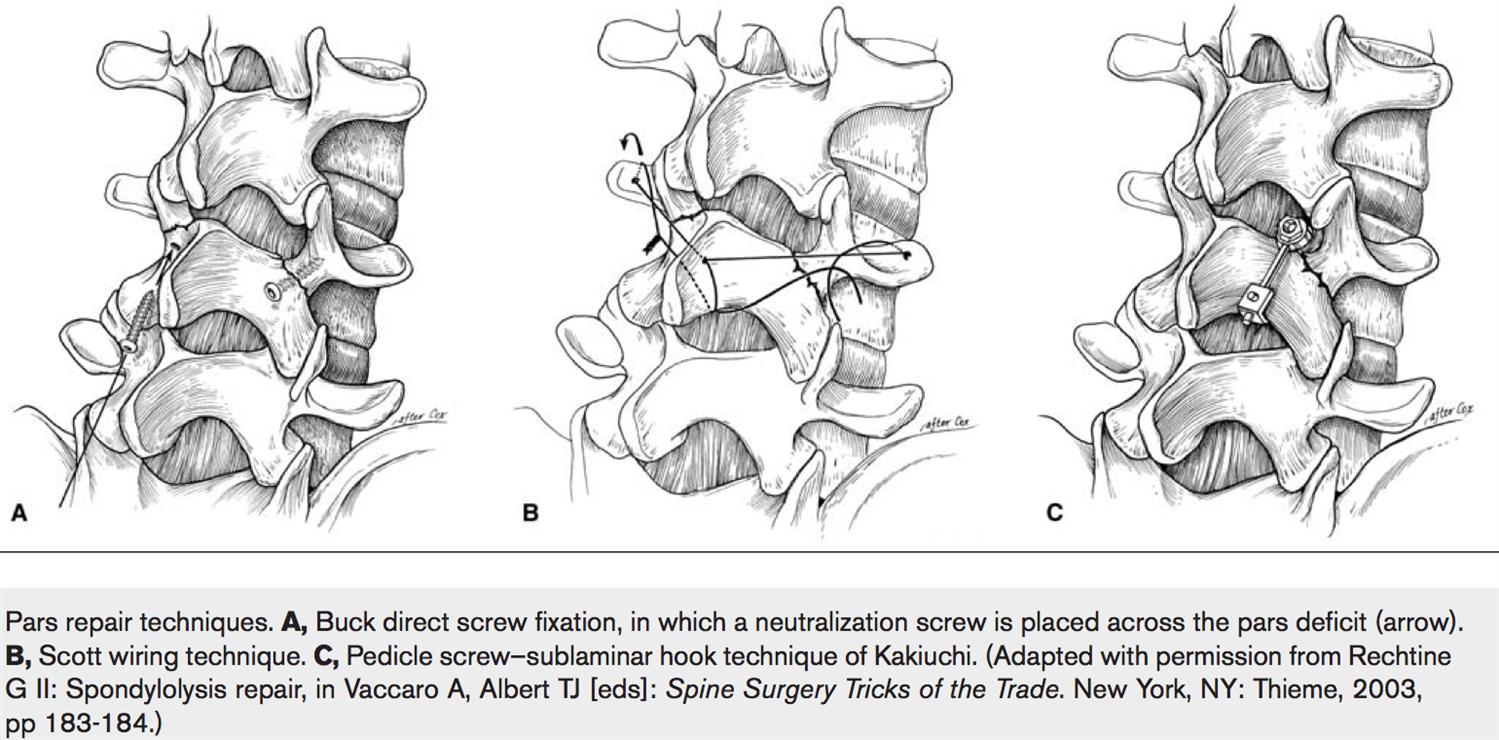 Question 4776 - Qbank - Orthobullets