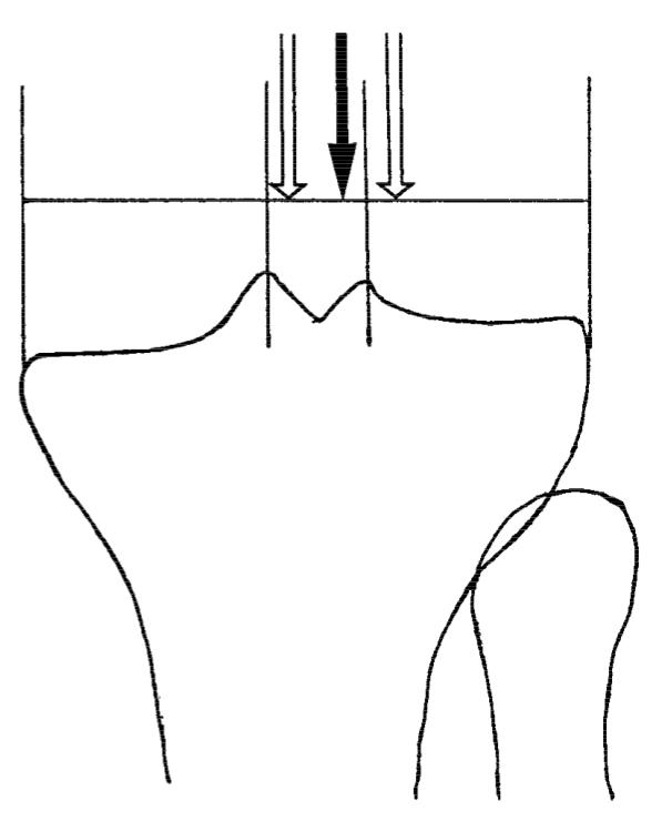 Question 4784 - Qbank - Orthobullets