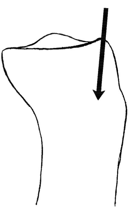 Question 4784 - Qbank - Orthobullets