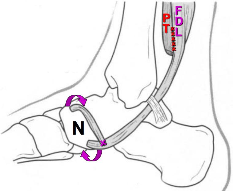 Question 4792 - Qbank - Orthobullets