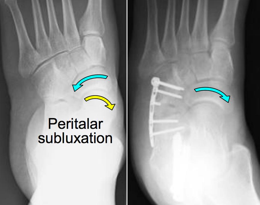 Question 4792 - Qbank - Orthobullets