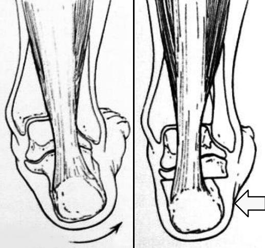 Question 4792 - Qbank - Orthobullets