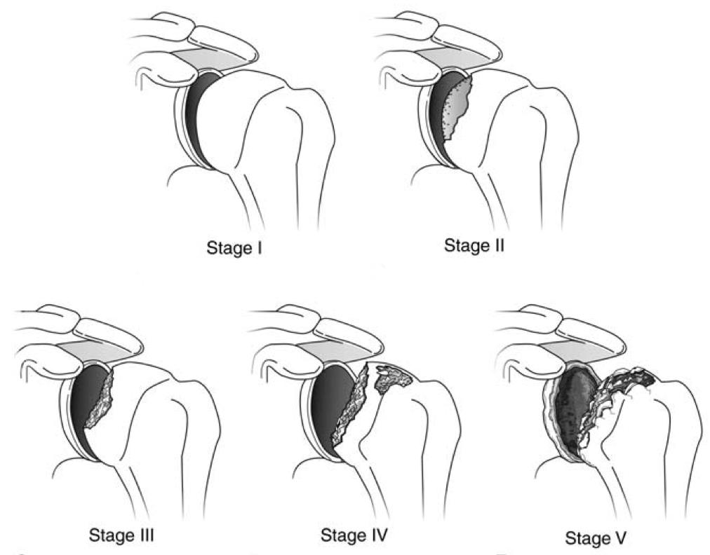 Question 4809 - Qbank - Orthobullets