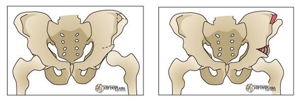Question 4812 - Qbank - Orthobullets