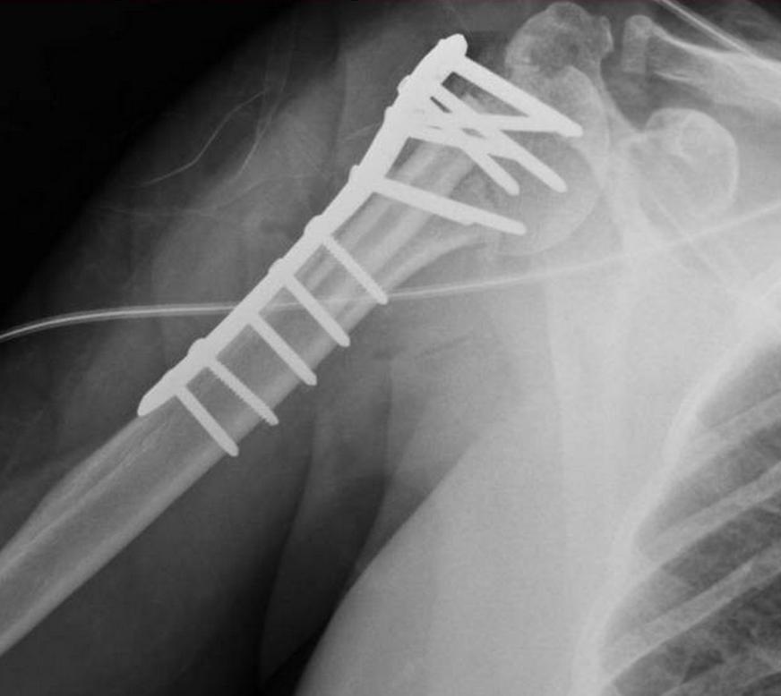 Question 4829 - Qbank - Orthobullets