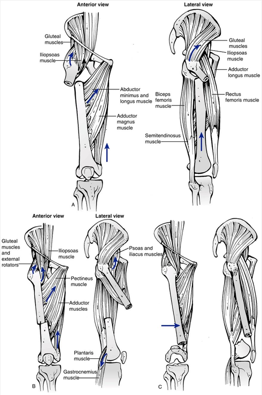 Question 4836 - Qbank - Orthobullets