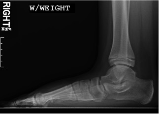 Question 4852 - Qbank - Orthobullets