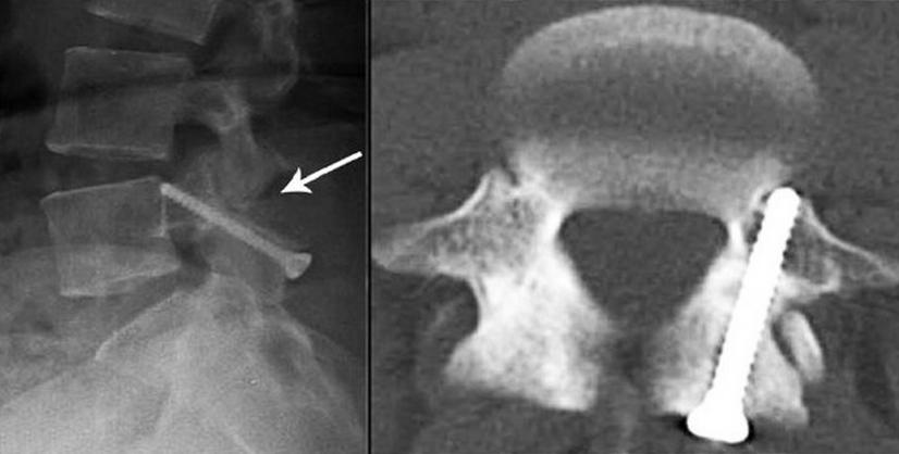 Question 4857 - Qbank - Orthobullets