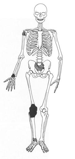 Question 4868 - Qbank - Orthobullets