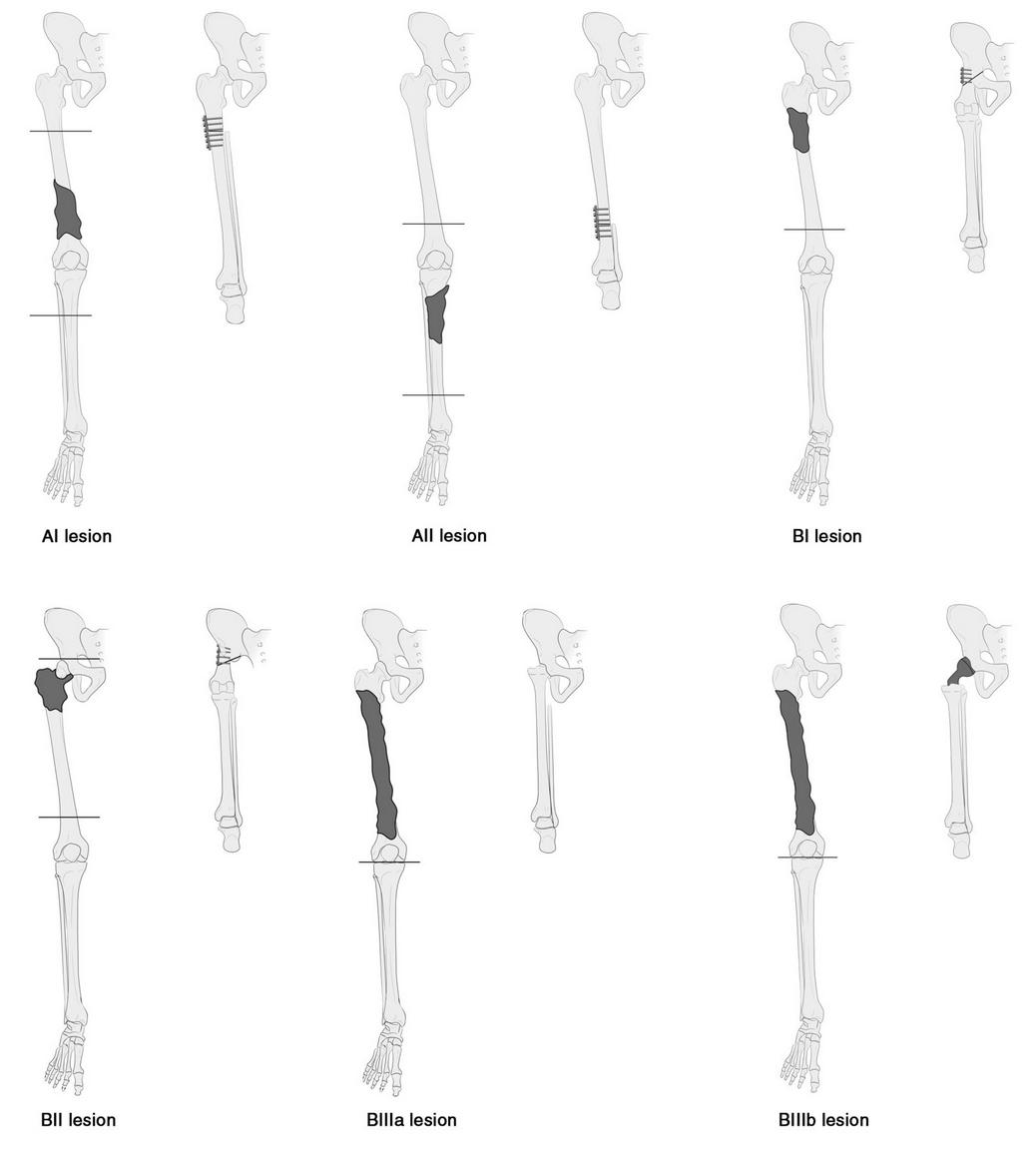 Question 4886 - Qbank - Orthobullets