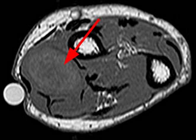 Question 4904 - Qbank - Orthobullets