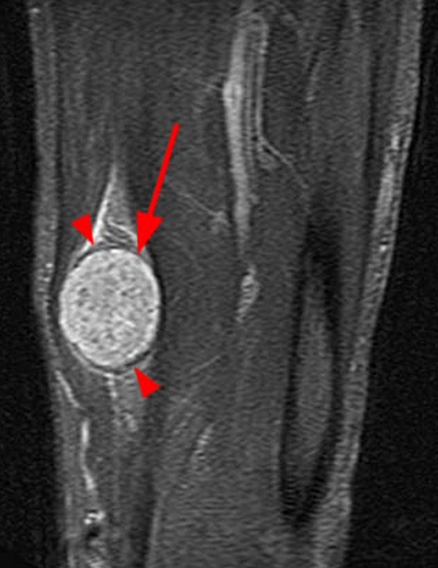 Question 4904 - Qbank - Orthobullets