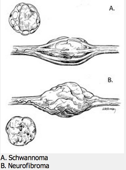 Question 4904 - Qbank - Orthobullets