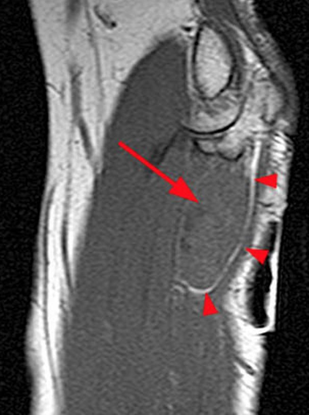 Question 4904 - Qbank - Orthobullets