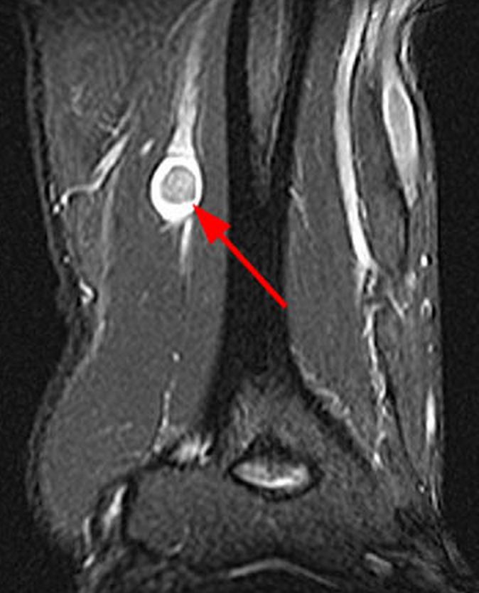 Question 4904 - Qbank - Orthobullets