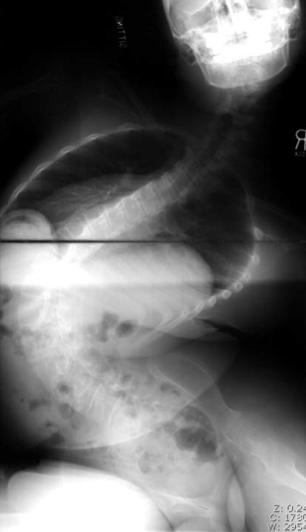 Question 4915 - Qbank - Orthobullets